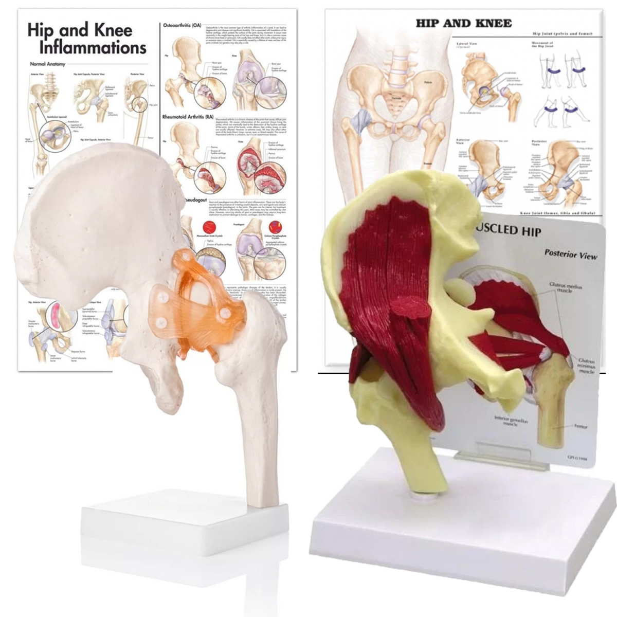 Hip Anatomy & Pathology Bundle — MYASKRO